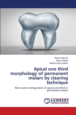 Apical one third morphology of permanent molars by clearing technique ...