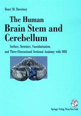 The Human Brain Stem and Cerebellum: Surface, Structure ...